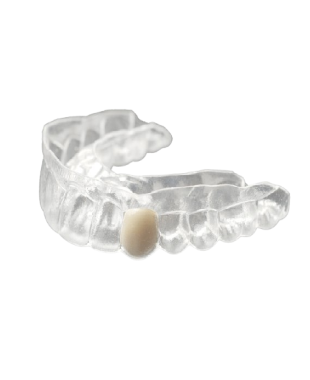 Aligner & Retainer Fabrication Services | SeaBrook Dental Lab